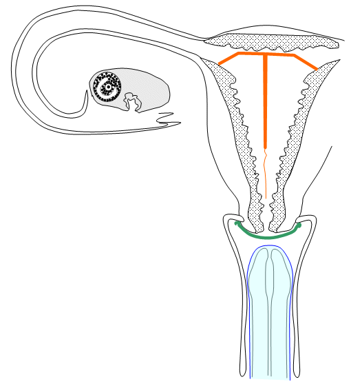 La Contraception | Superprof