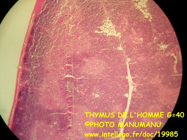 Le Thymus Humain Vu au Microscope