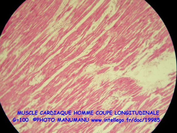 Les Fibres Musculaires Cardiaques au Microscope