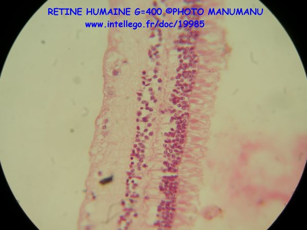 Analyse Microscopique de la Rétine Humaine