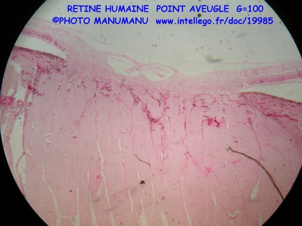 Analyse Microscopique de la Rétine Humaine