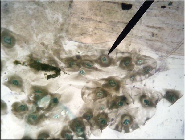 Les Cellules et Chromosomes du Ver de Vase